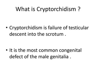 Cryptorchidism | PPTX