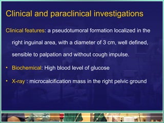 Cryptorchidism in adults - case report | PPT