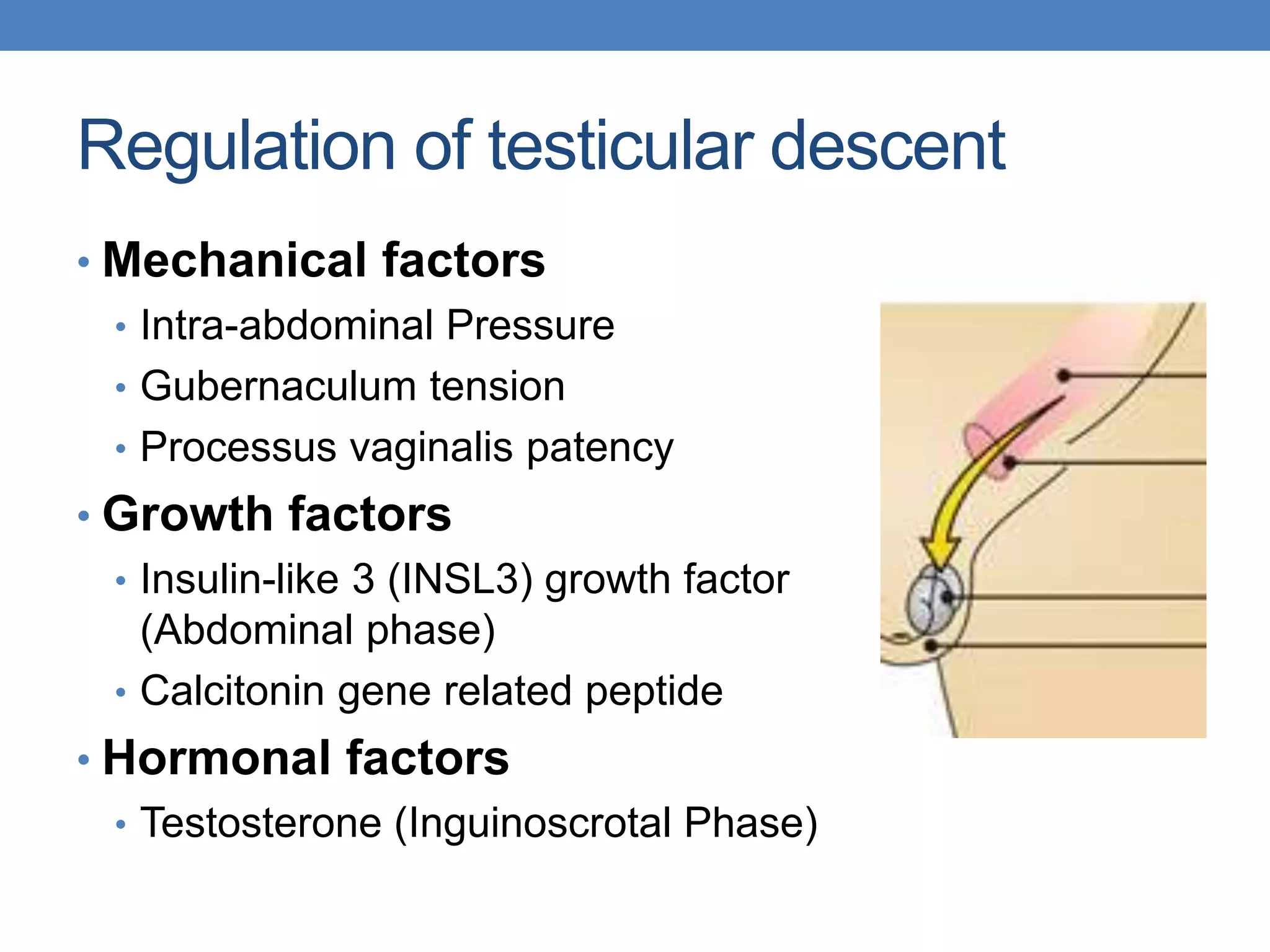 Cryptorchidism (Undescended Testes) | PPT