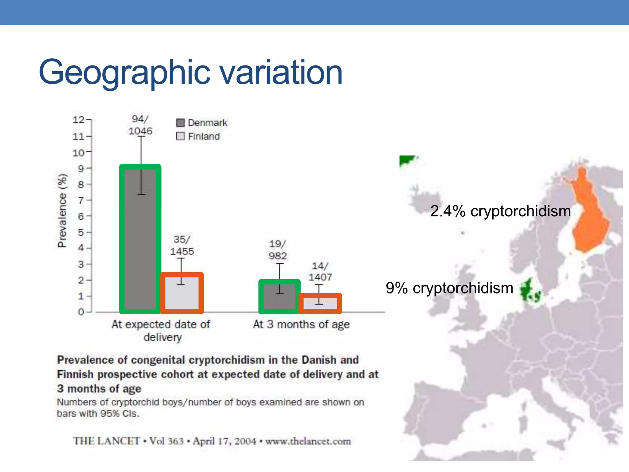 Cryptorchidism (Undescended Testes) | PPT
