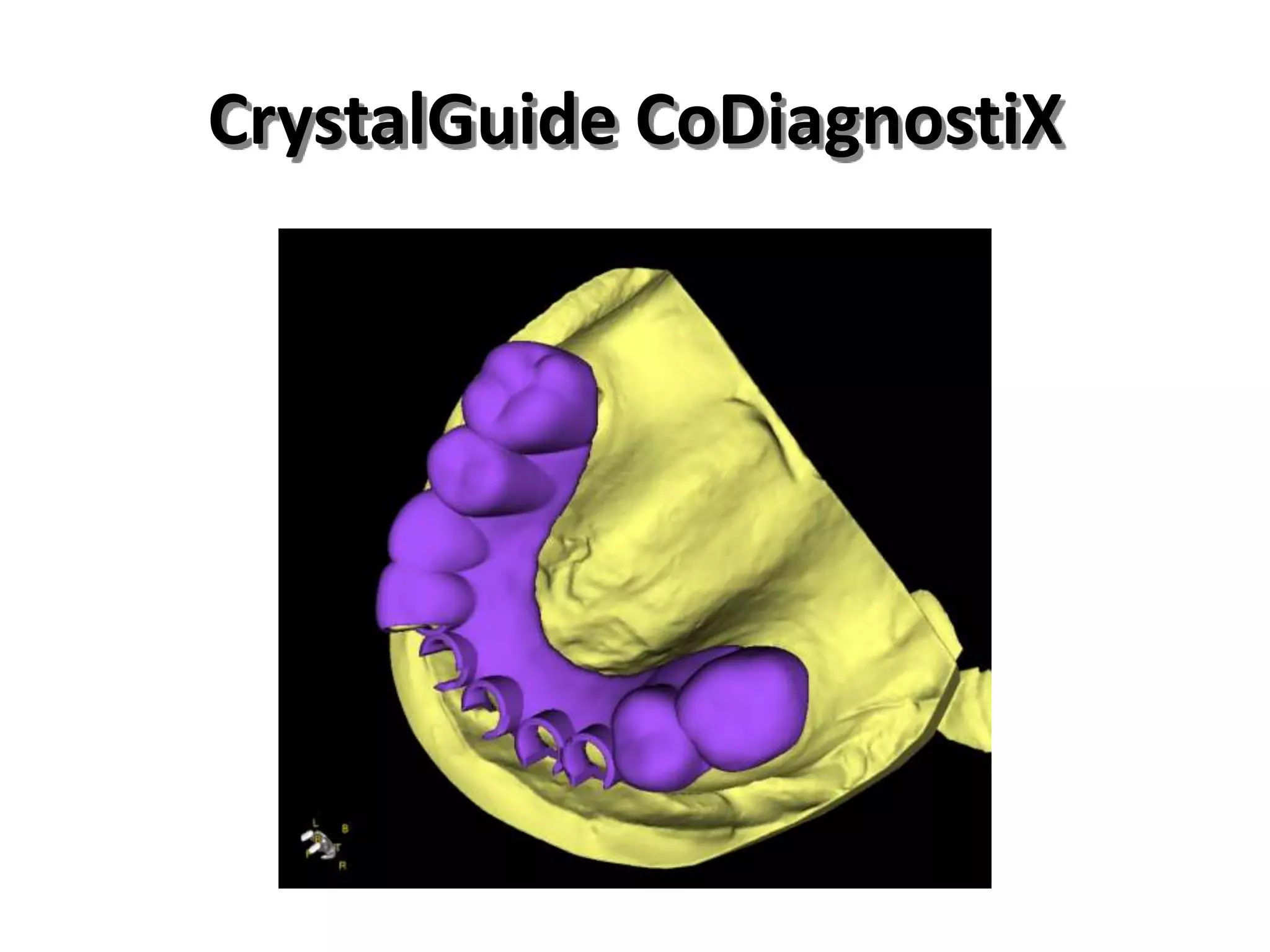 Crystal guide codiagnostix workflow | PPTX