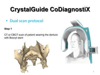 Crystal guide codiagnostix workflow | PPT
