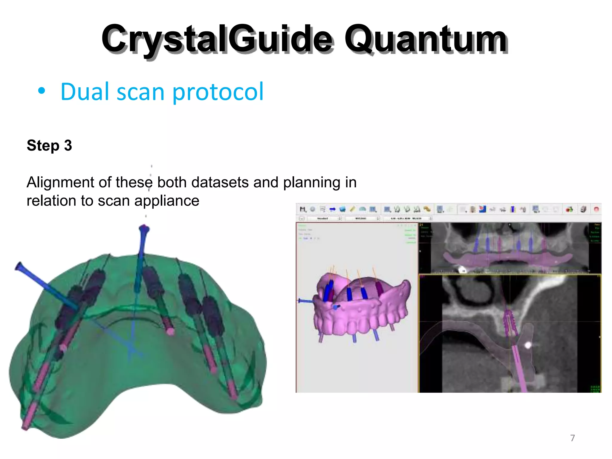 Crystal guide scan protocol | PPTX