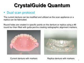 Crystal guide scan protocol | PPTX | Dental Health | Diseases and ...