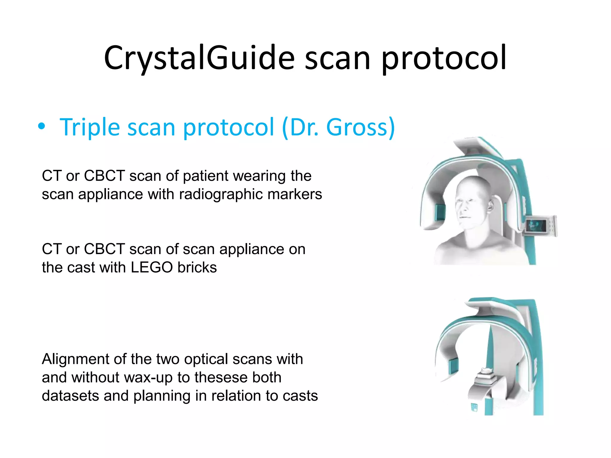 Crystal guide scan protocol | PPTX | Dental Health | Diseases and ...