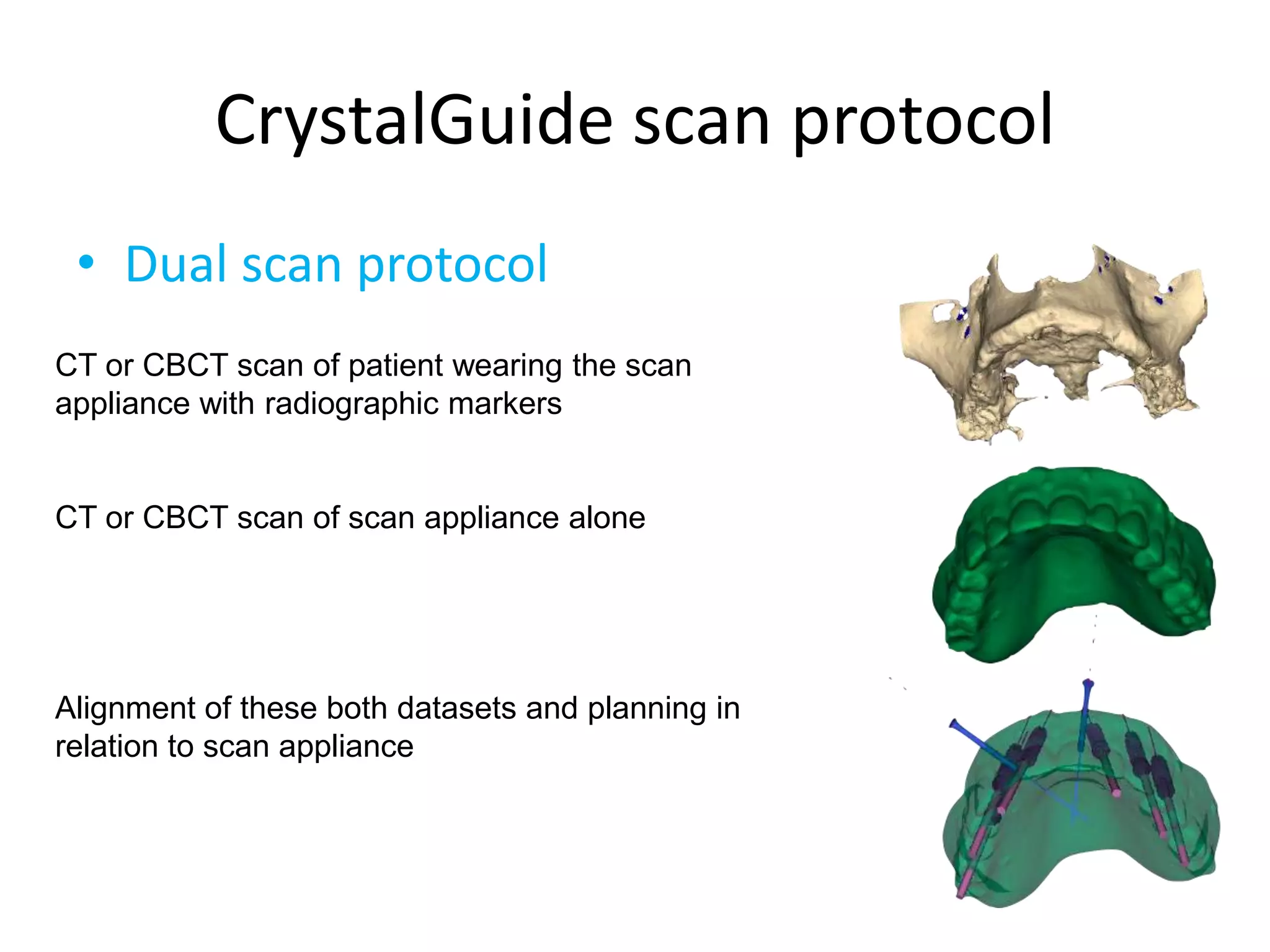 Crystal guide scan protocol | PPTX | Dental Health | Diseases and ...