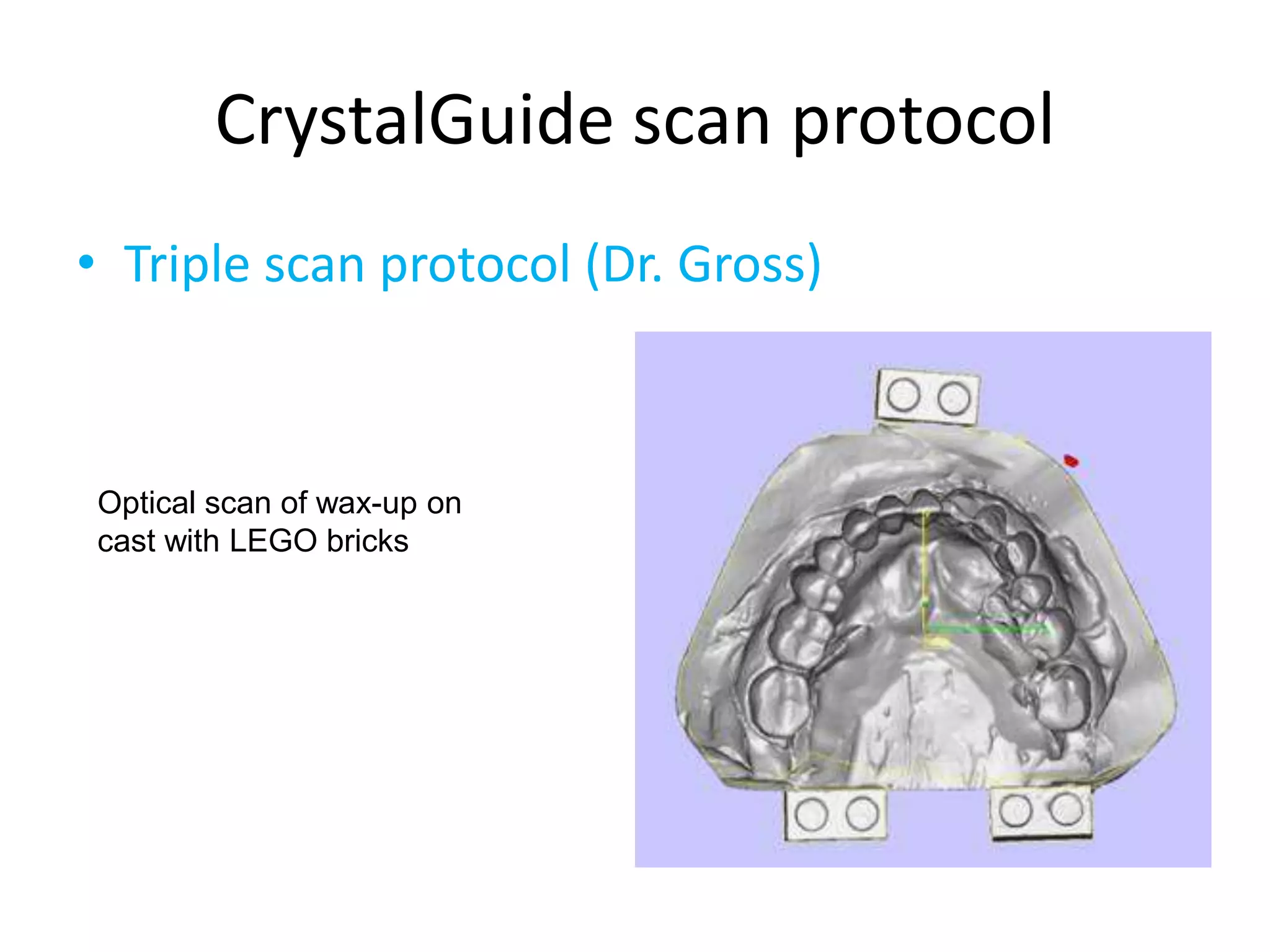 Crystal guide scan protocol | PPTX | Dental Health | Diseases and Conditions