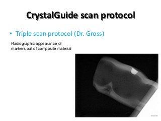 Crystal guide scan protocol | PPTX | Dental Health | Diseases and Conditions