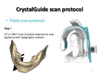 Crystal guide scan protocol | PPTX | Dental Health | Diseases and ...