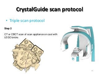 Crystal guide scan protocol | PPTX | Dental Health | Diseases and Conditions