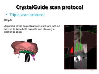 Crystal guide scan protocol | PPTX | Dental Health | Diseases and ...