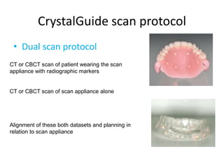 Crystal guide scan protocol | PPTX | Dental Health | Diseases and ...