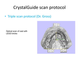 Crystal guide scan protocol | PPTX | Dental Health | Diseases and Conditions