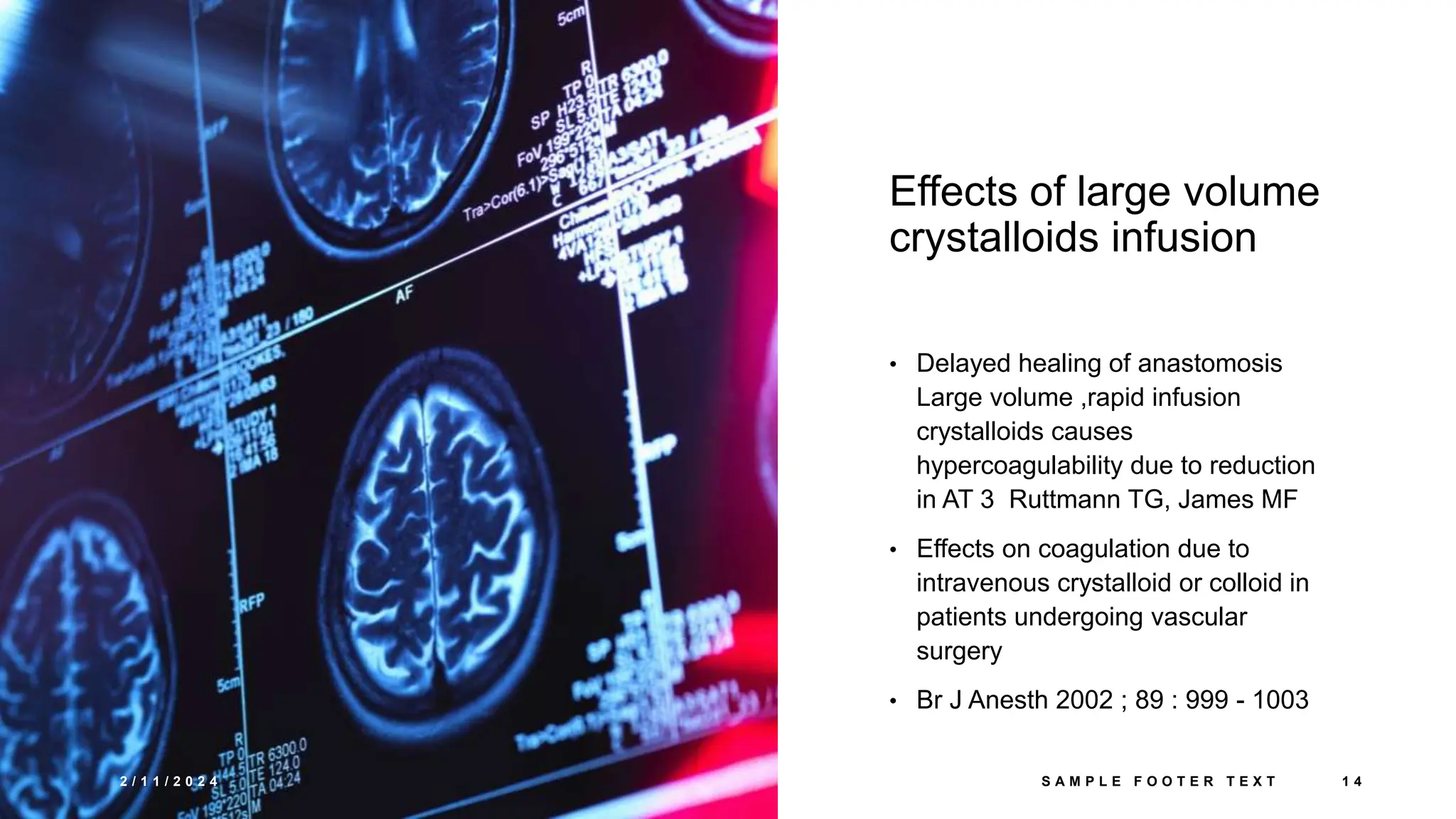 Crystalloids iv fluids management anaesthesia | PPT | Free download