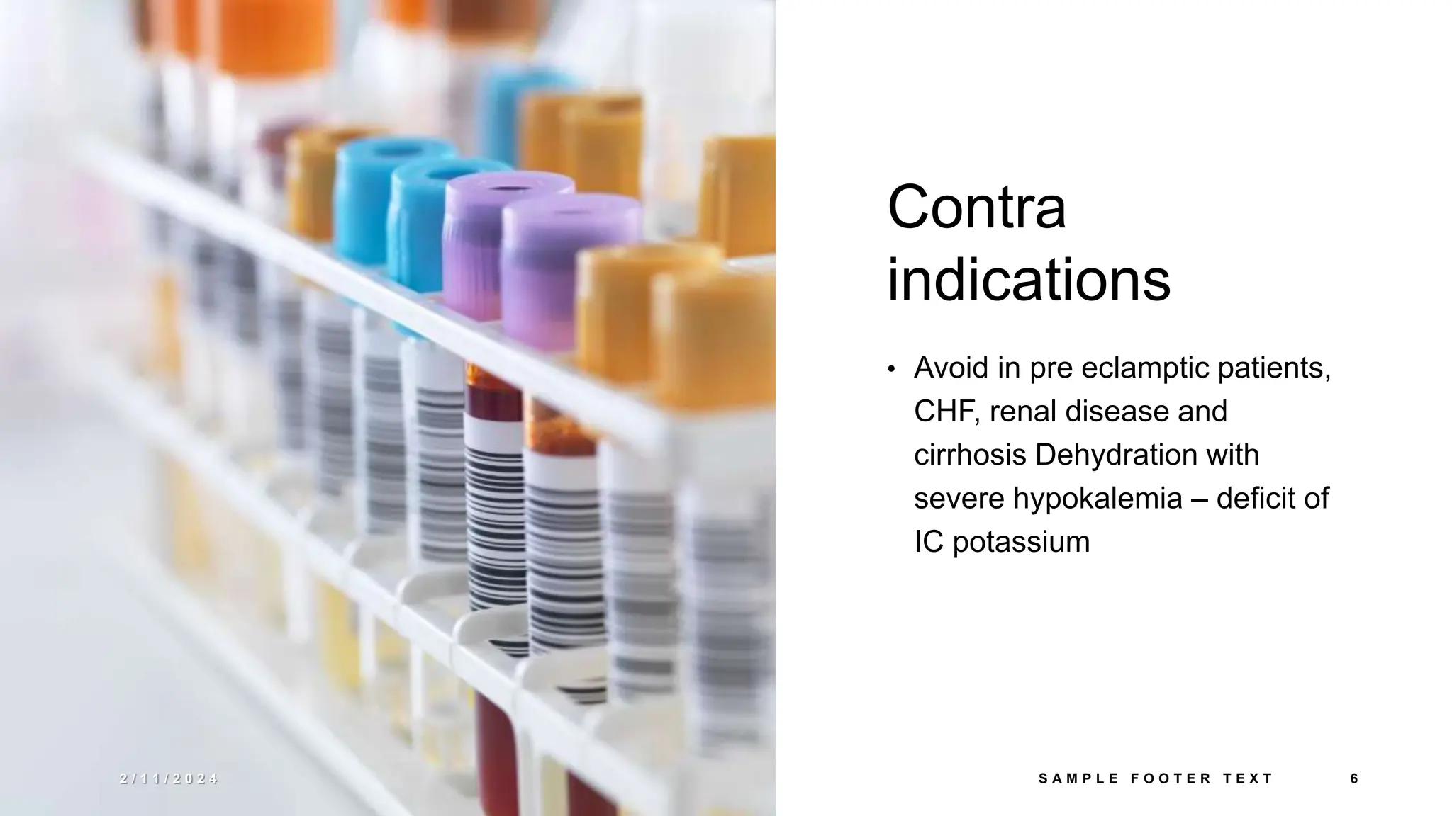 Crystalloids iv fluids management anaesthesia | PPT