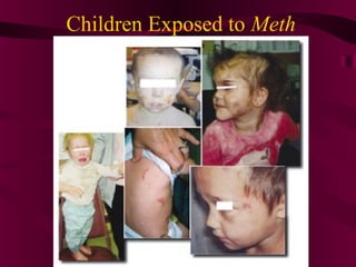 "Crystal Meth" For Teens | PPT