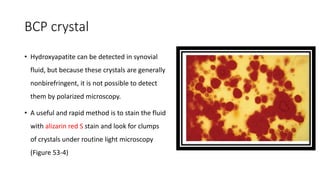 Crystals in rheumatic diseases.pptx