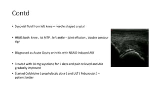 Crystals in rheumatic diseases.pptx