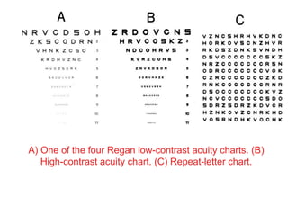 Contrast sensitivity | PDF