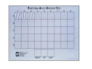 Contrast sensitivity | PDF