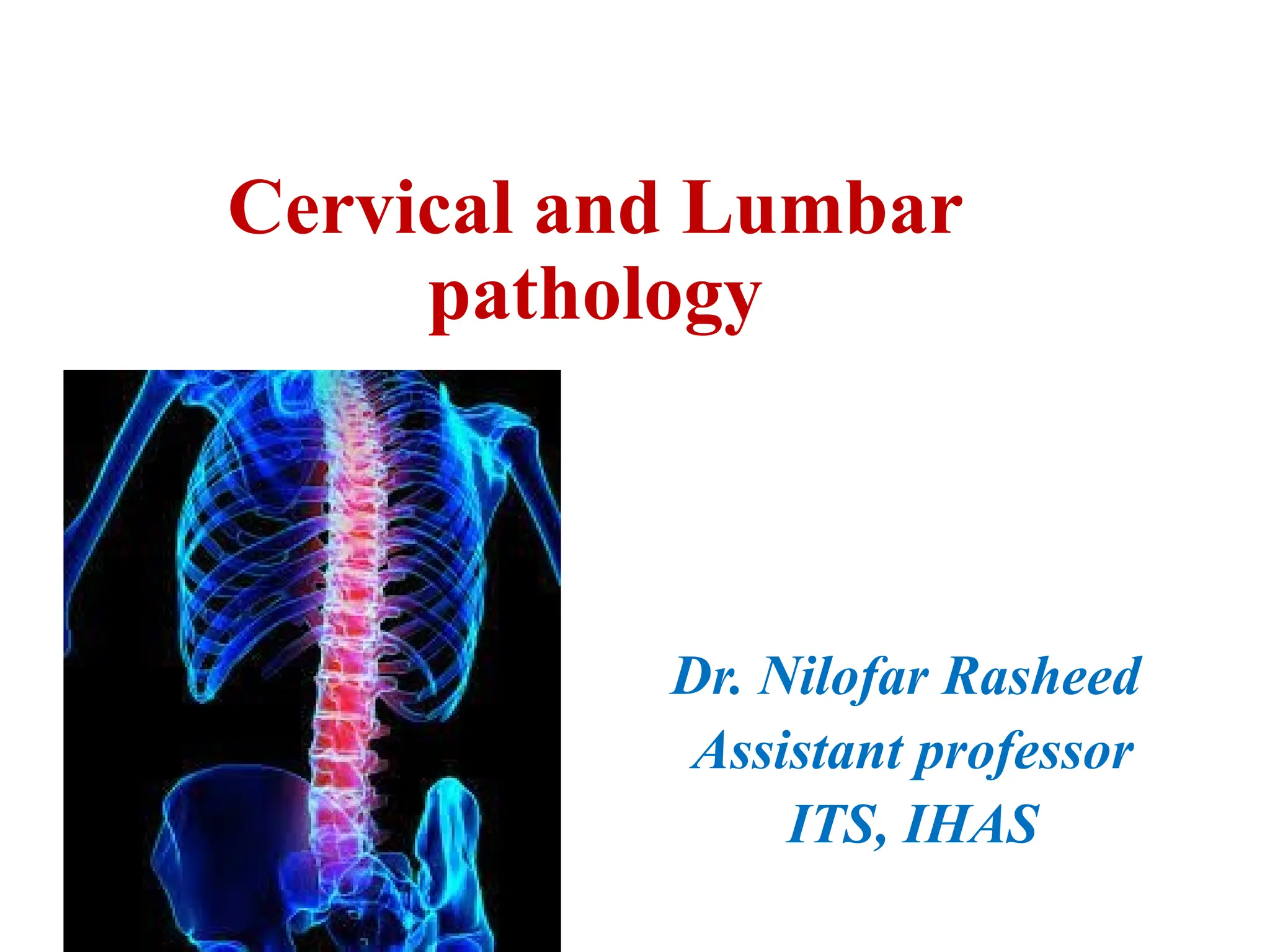 Cervical and Lumbar pathology.ppt Pathologies here can affect neck and ...