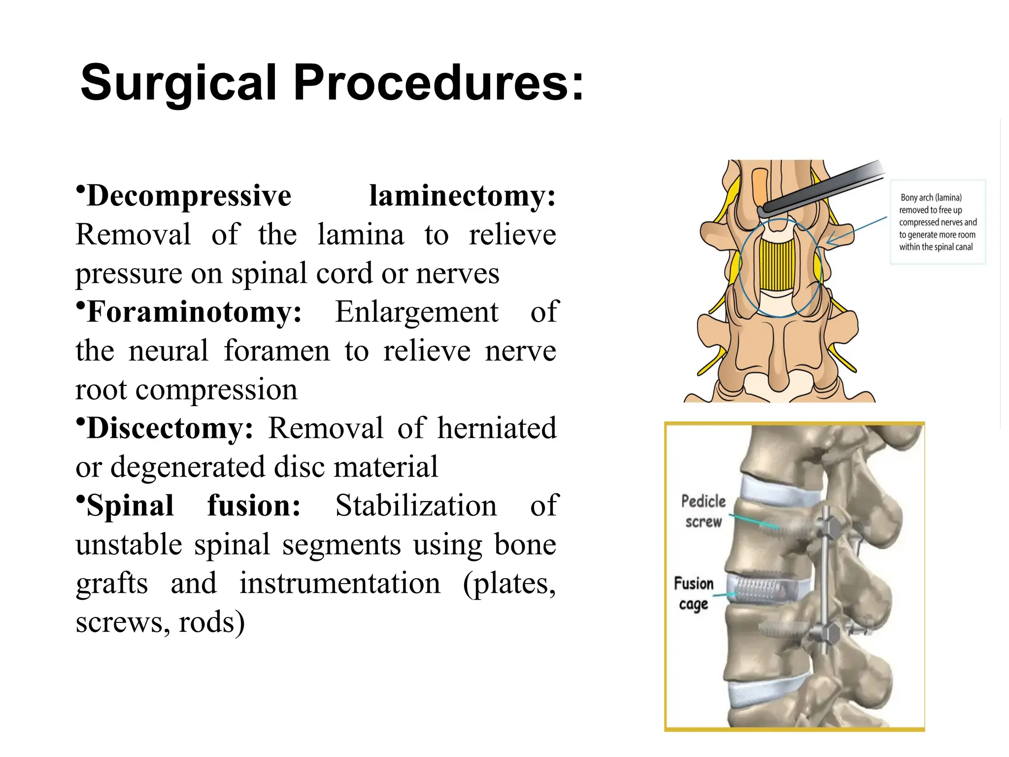 Cervical and Lumbar pathology.ppt Pathologies here can affect neck and ...