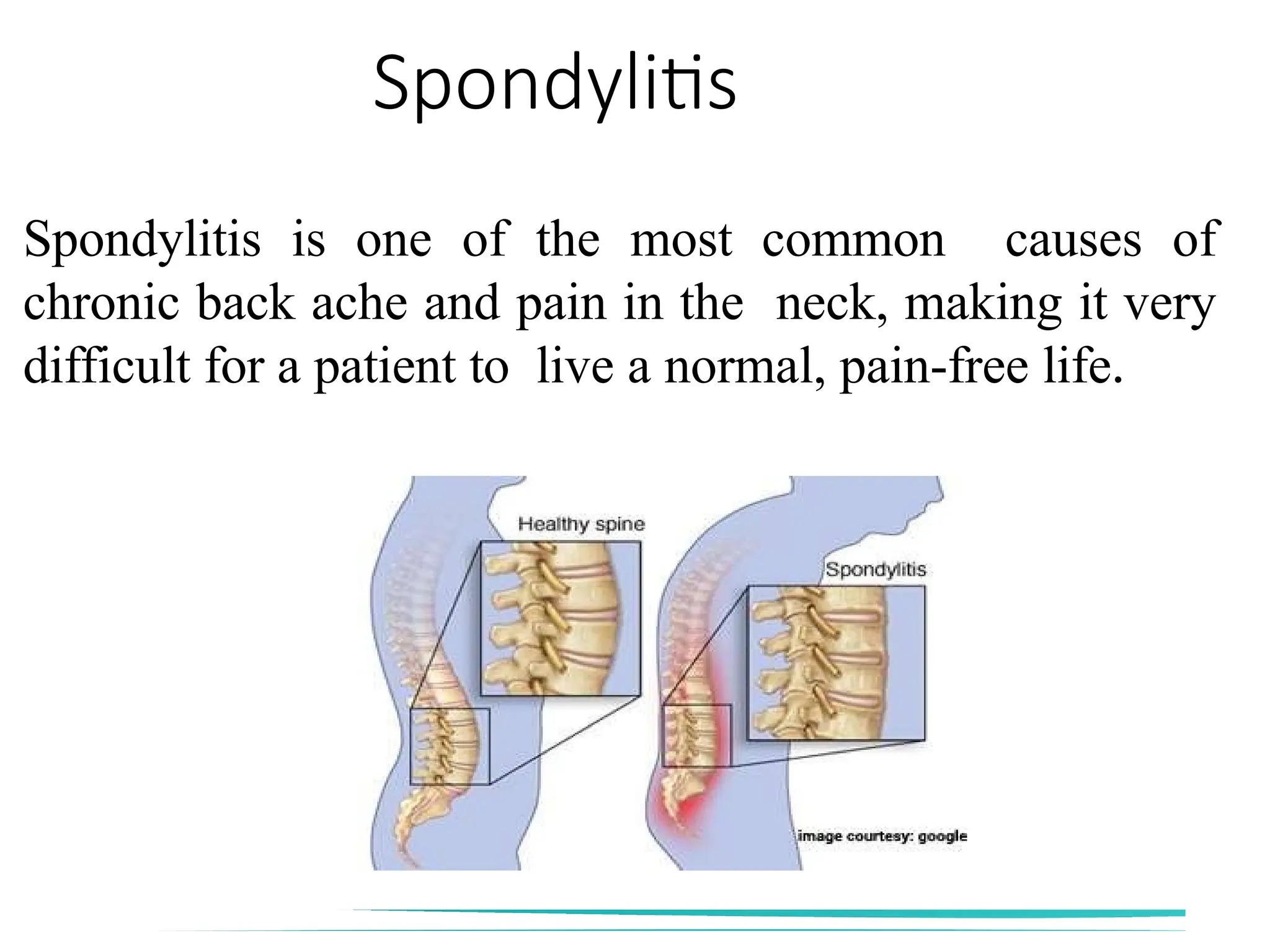 Cervical and Lumbar pathology.ppt Pathologies here can affect neck and ...
