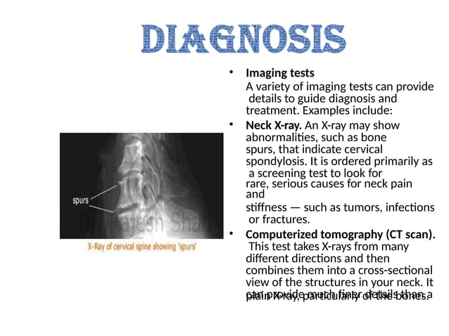 Cervical and Lumbar pathology.ppt Pathologies here can affect neck and ...