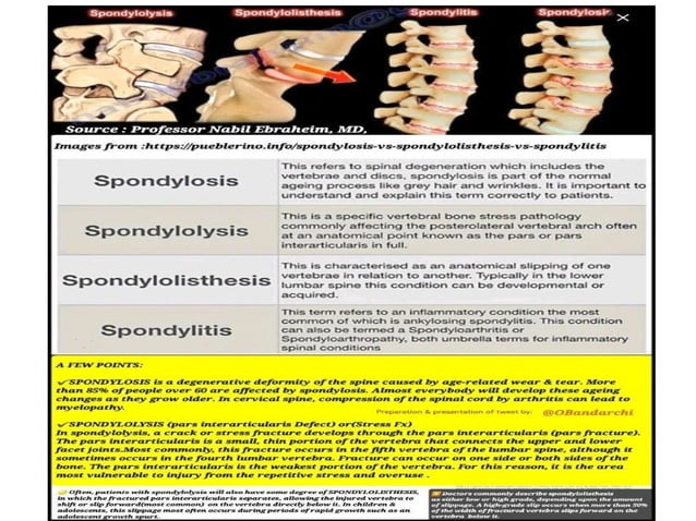 Cervical and Lumbar pathology.ppt Pathologies here can affect neck and back mobility, spinal ...