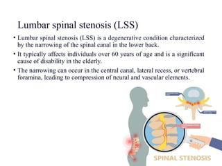 Cervical and Lumbar pathology.ppt Pathologies here can affect neck and ...