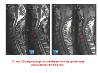 Cervical and Lumbar pathology.ppt Pathologies here can affect neck and ...