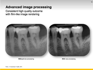 New Carestream CS7200 chairside intra oral x ray from 360 Visualise | PPTX