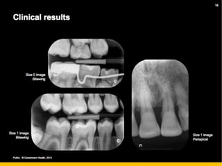New Carestream CS7200 chairside intra oral x ray from 360 Visualise | PPTX