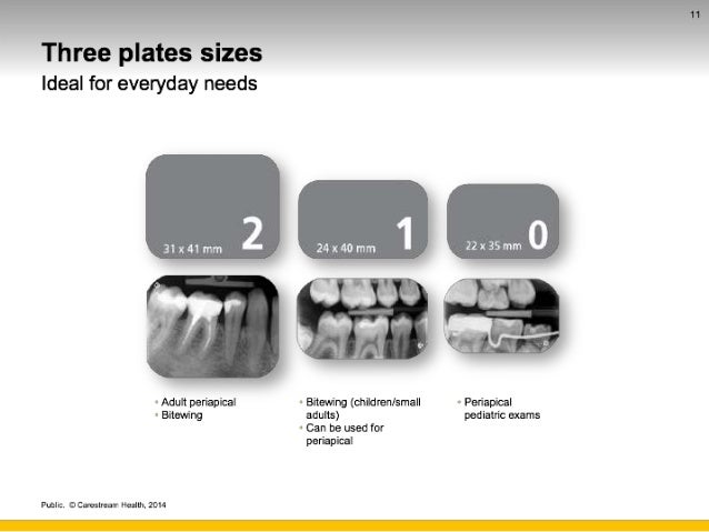 New Carestream CS7200 chairside intra oral x ray from 360 Visualise