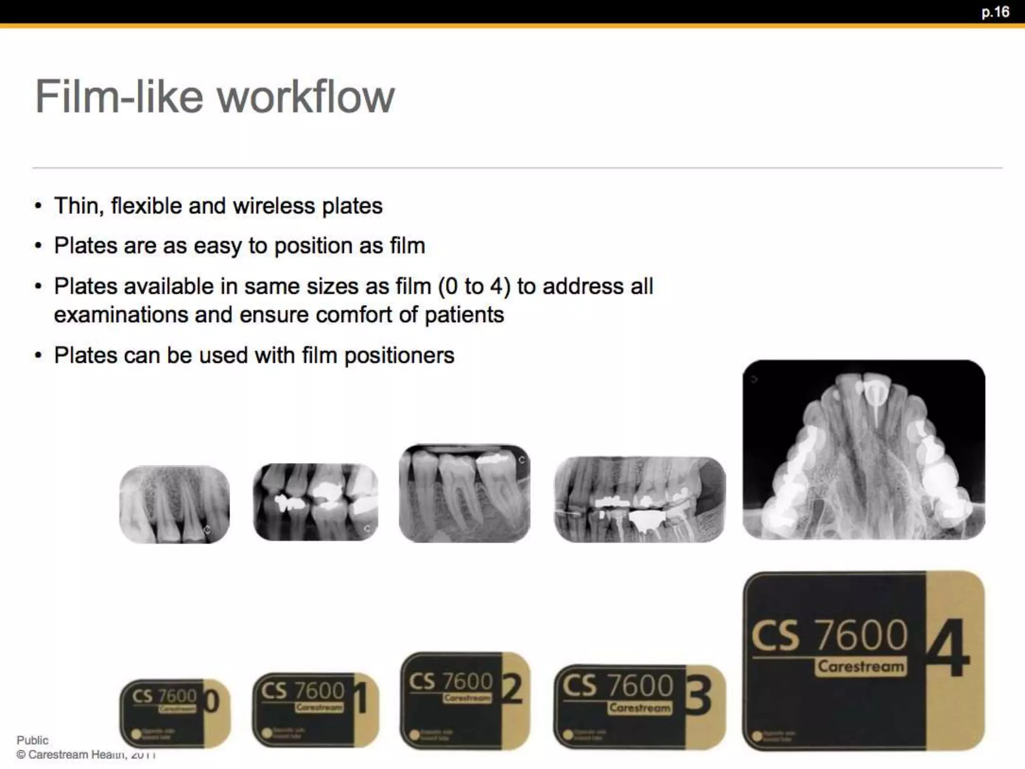 Carestream CS7600 Intra Oral Digital Xray System | PPT