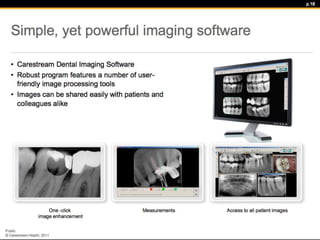 Carestream CS7600 Intra Oral Digital Xray System | PPT