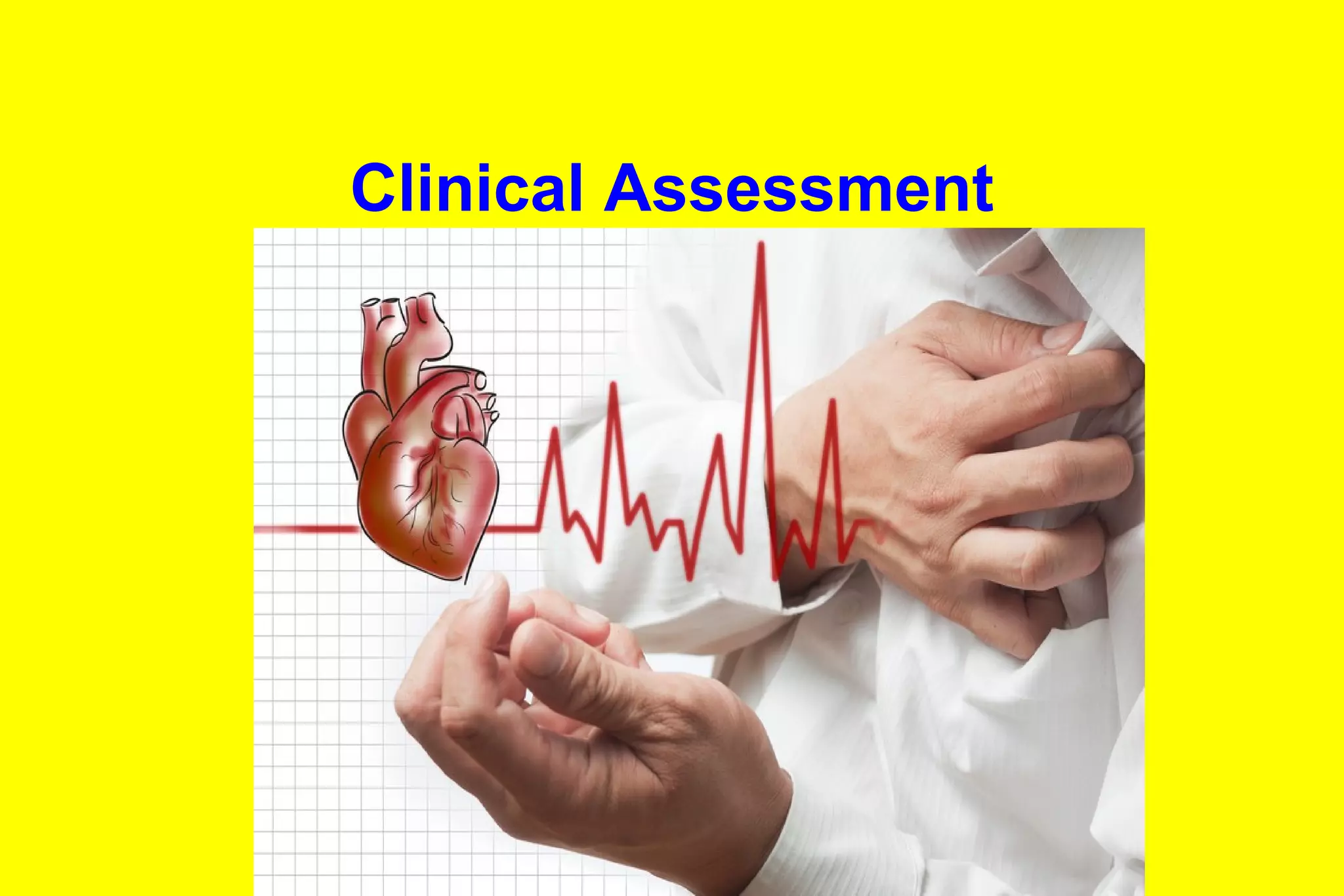 Chronic Stable Angina- Diagnosis & management | PPT