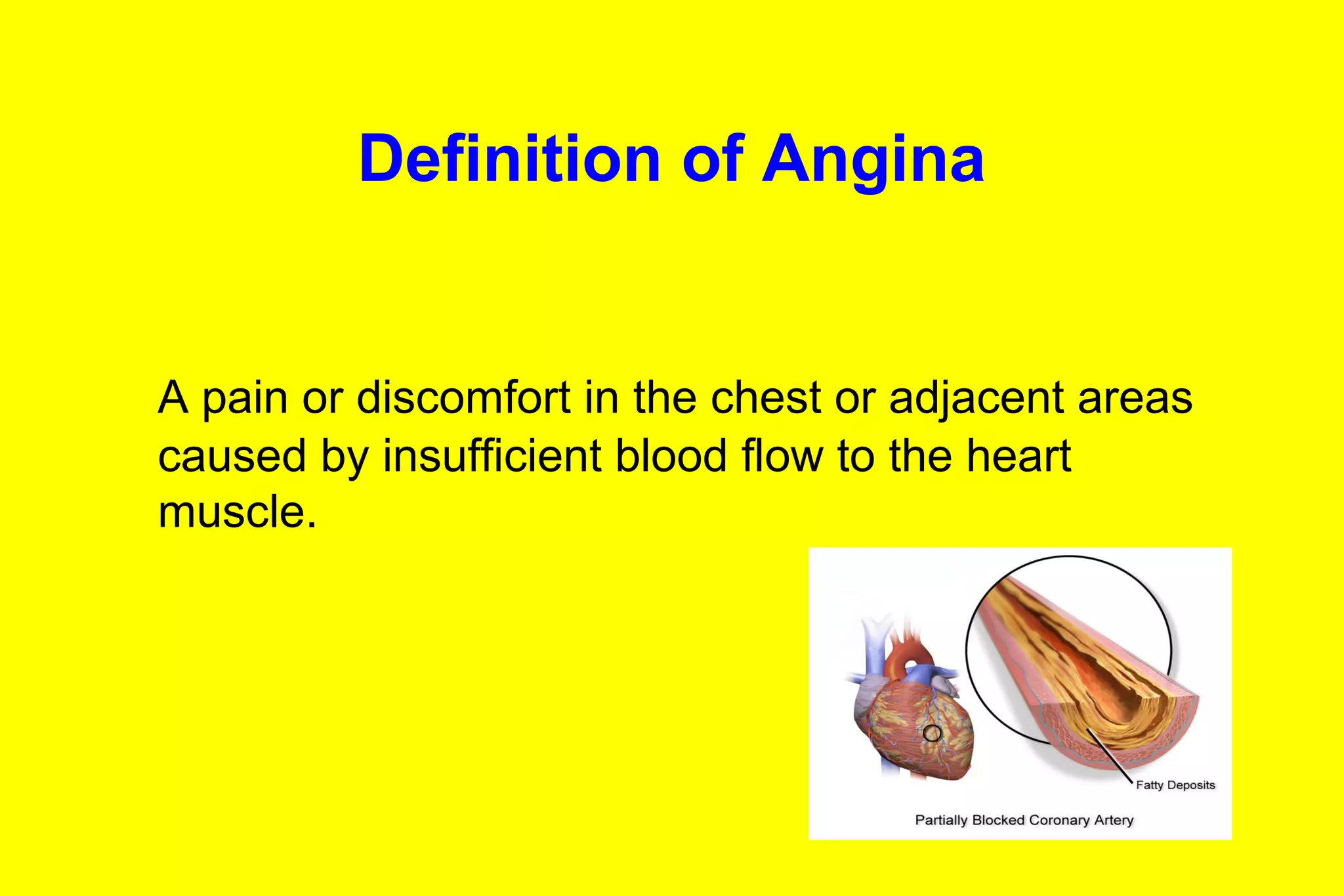 Chronic Stable Angina- Diagnosis & management | PPT
