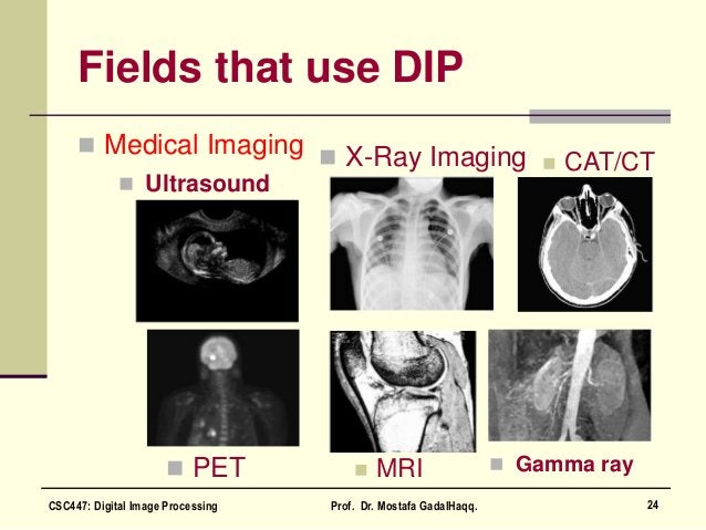 Digital Image Processing: An Introduction | PDF | Photo Editing ...