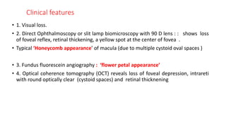 Cscr ( central serous chorioretinopathy ) | PPTX