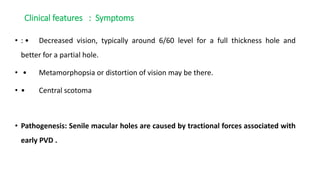 Cscr ( central serous chorioretinopathy ) | PPTX