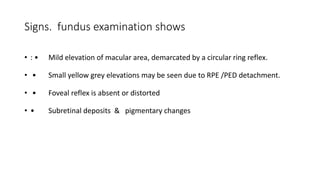 Cscr ( central serous chorioretinopathy ) | PPTX