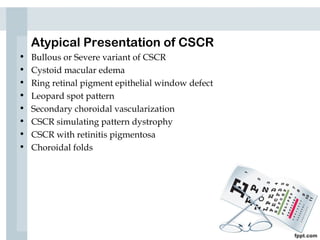 Central Serous Chorioretinopathy Dr Md Ferdous Islam | PPT