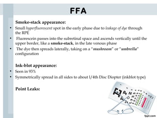 Central Serous Chorioretinopathy Dr Md Ferdous Islam | PPT