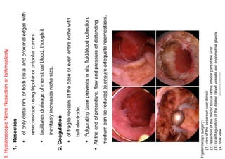 CAESAREAN SCAR DEFECT | PPT