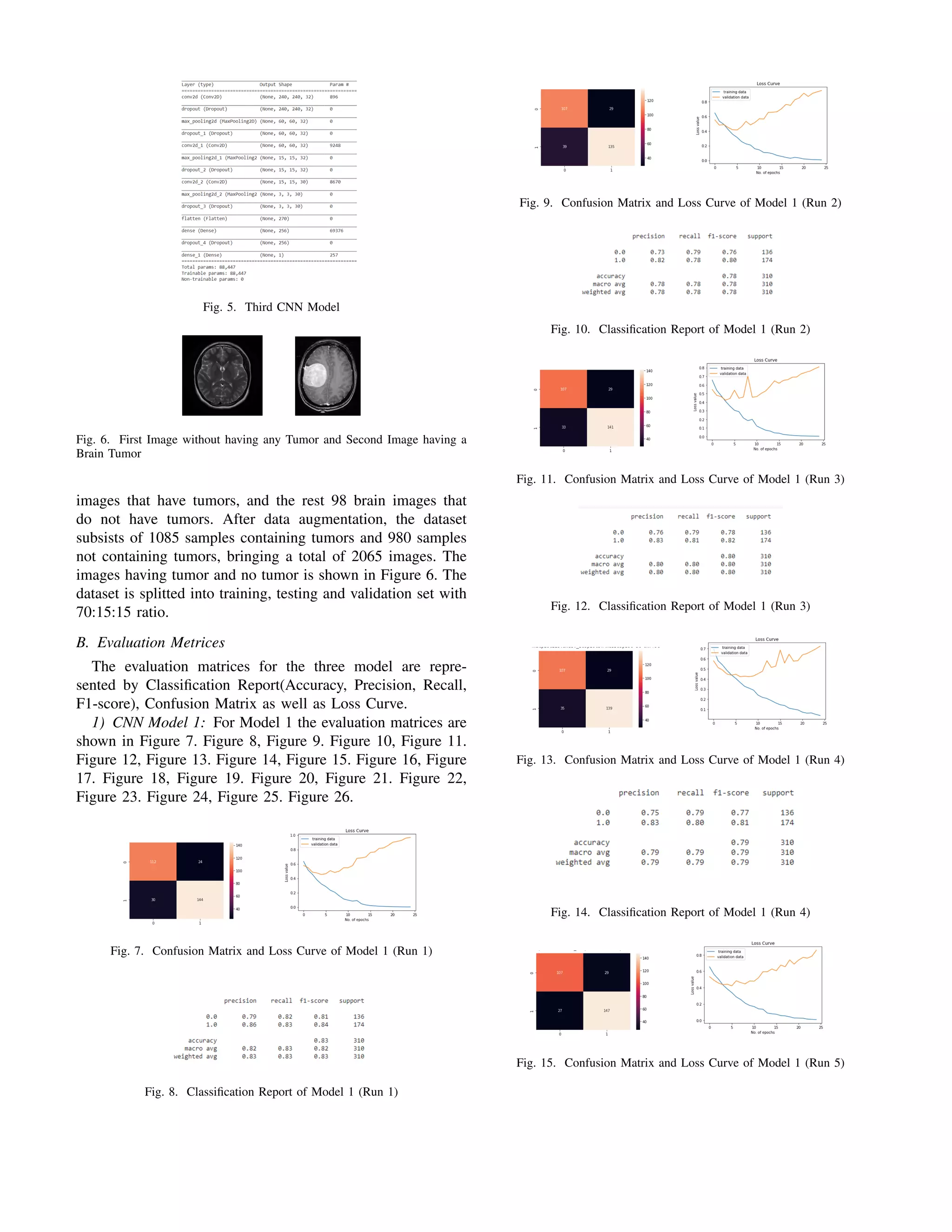 Brain Tumor Detection using CNN | PDF