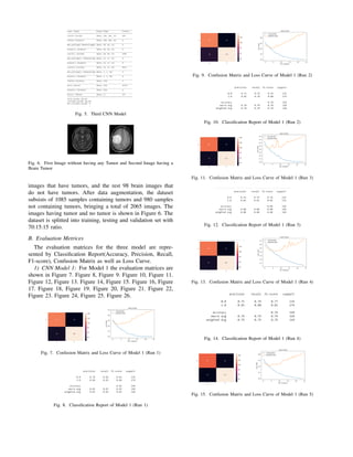 Brain Tumor Detection using CNN | PDF