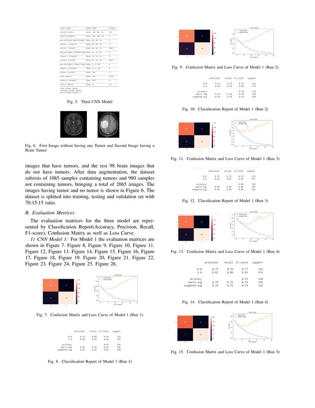 Brain Tumor Detection Using Cnn