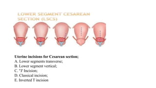 A brief introduction to c section and how its done. | PPTX