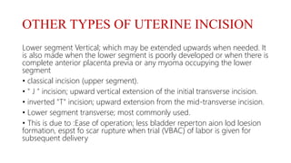 A brief introduction to c section and how its done. | PPT